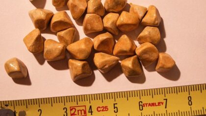 What are Different Type of Gall Stones? - Santokh Hospital